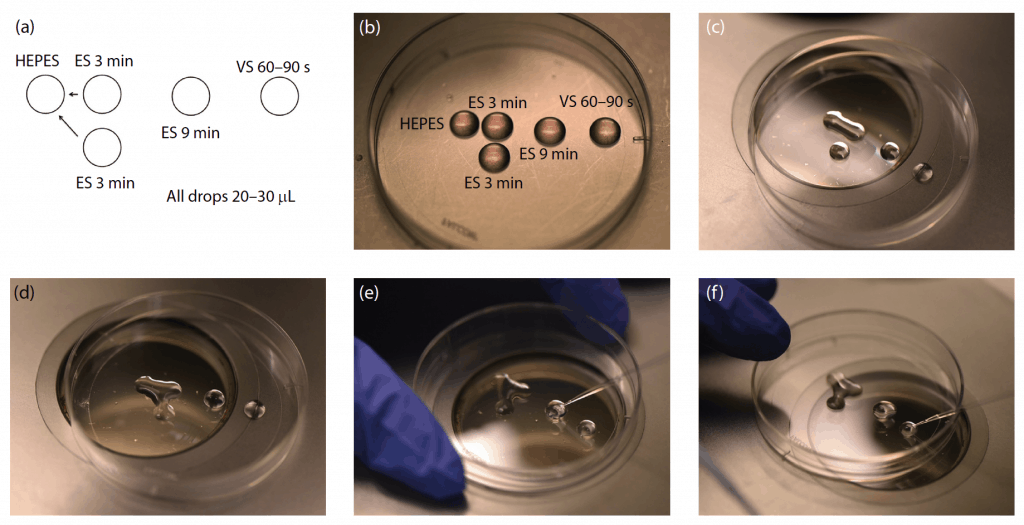 Chapter by Dr. Silber in Textbook: Vitrification in Assisted ...