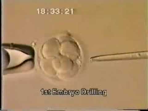 Assisted Embryo Hatching - The Infertility Center of St. Louis