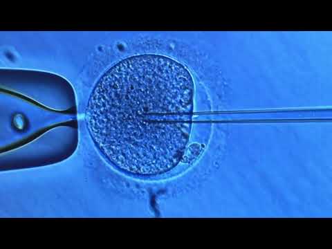 IFC STL is the only center in the US using piezo for ICSI, with no egg ...